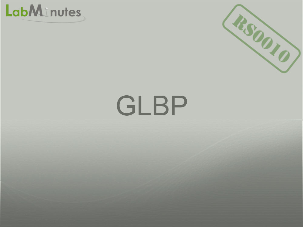 RS0010 - GLBP | Lab Minutes